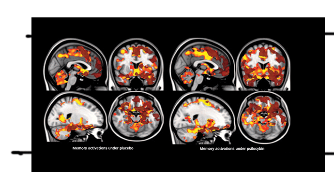 Implications for psychedelic-assisted psychotherapy: functional ...