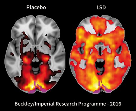 What Is The Ego, And How Do Psychedelics Shut It Down? — The Beckley ...