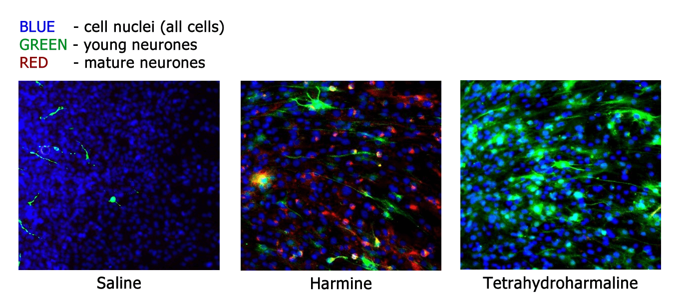 Psychedelics Promote Neural Plasticity | The Beckley FoundationThe ...