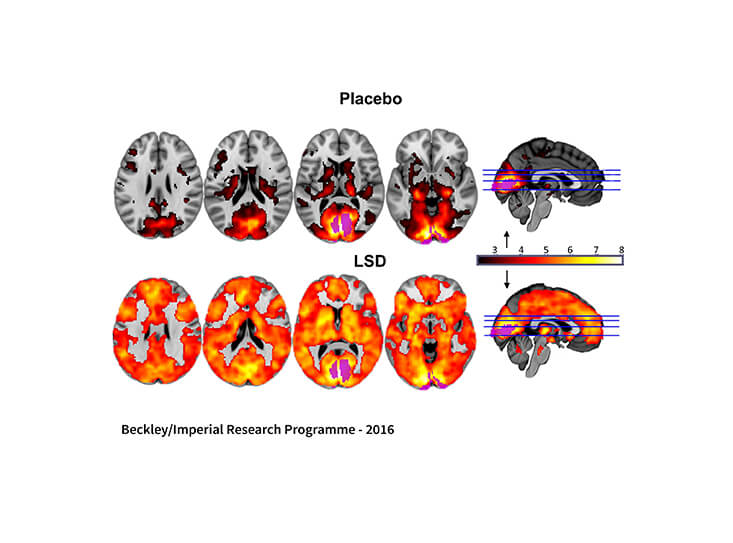 Acute effects of lysergic acid diethylamide (LSD) on resting brain ...