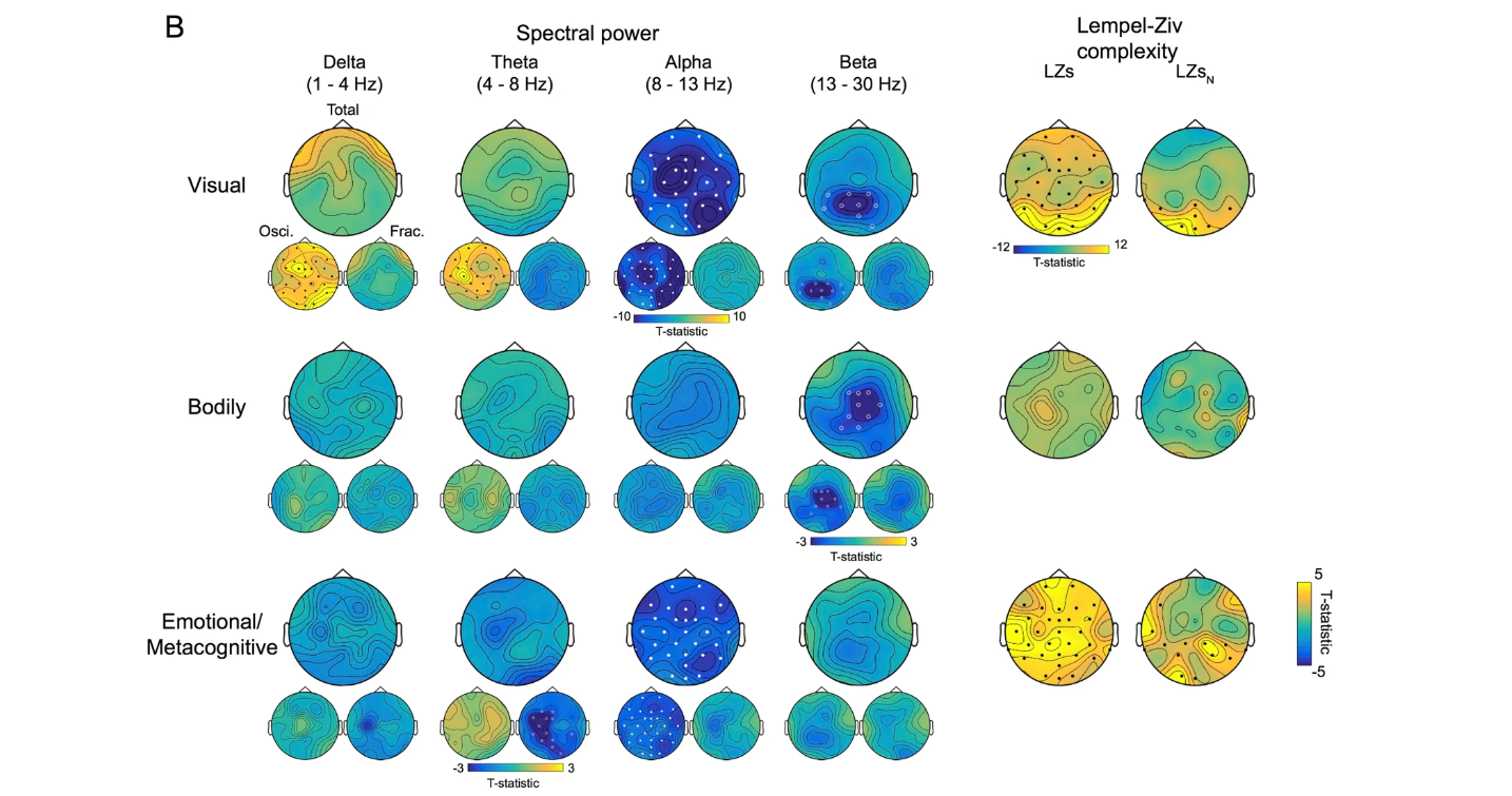 Neural correlates of the DMT experience assessed with multivariate EEG ...